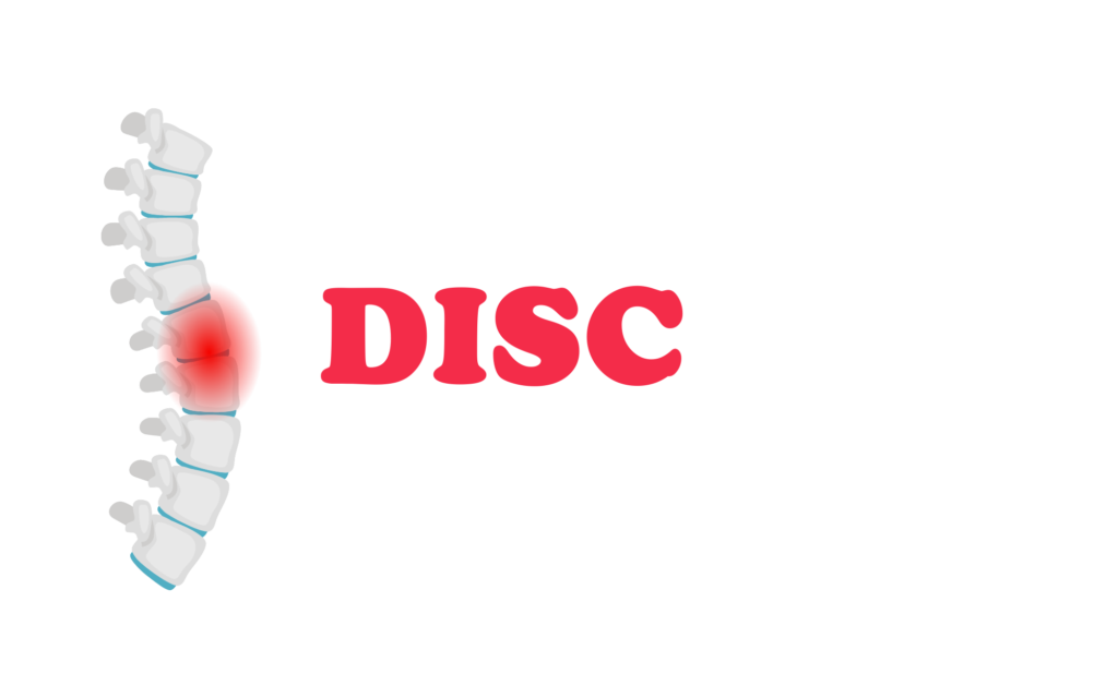 Nashville Disc Center – Spine Doctor and Spine Specialist