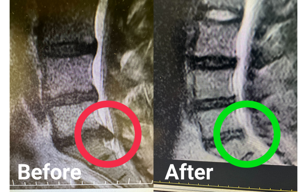 Nashville Disc Center – Spine Doctor and Spine Specialist